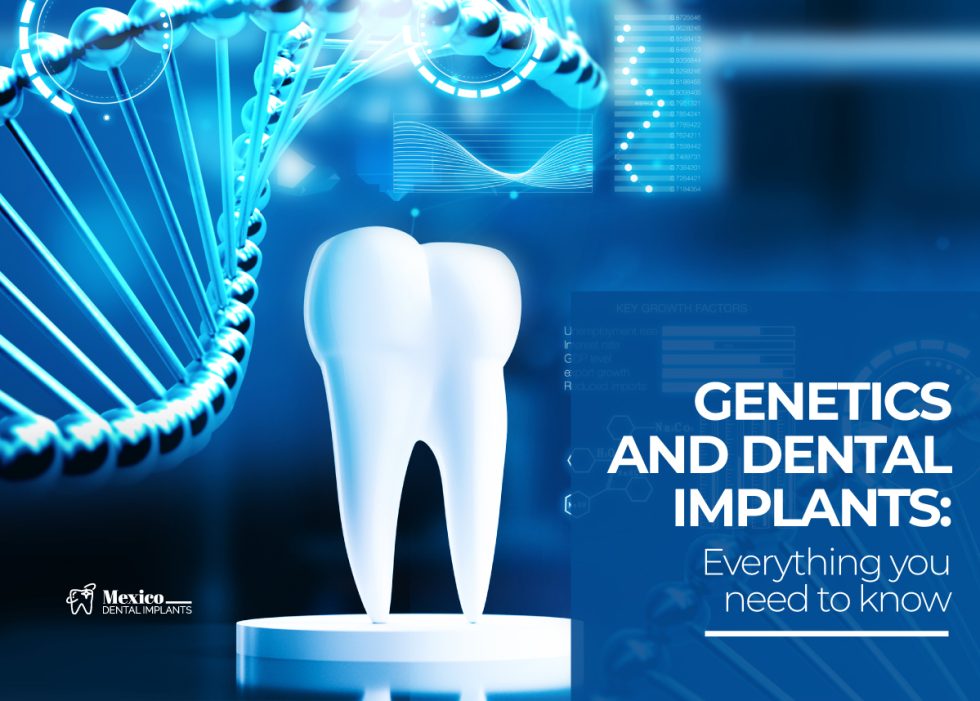 Genetics and Dental Implants | Mexico Dental Implants